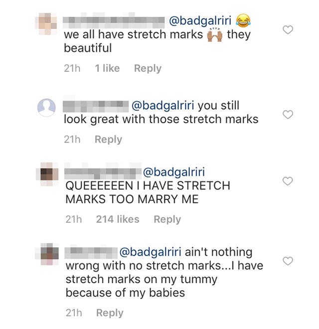 Rihanna praised for spreading positive message about stretch marks ...