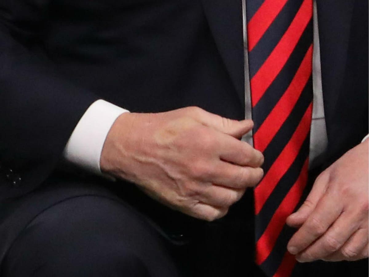 Trump's hand left with thumbprint after Macron handshake at G7 summit ...