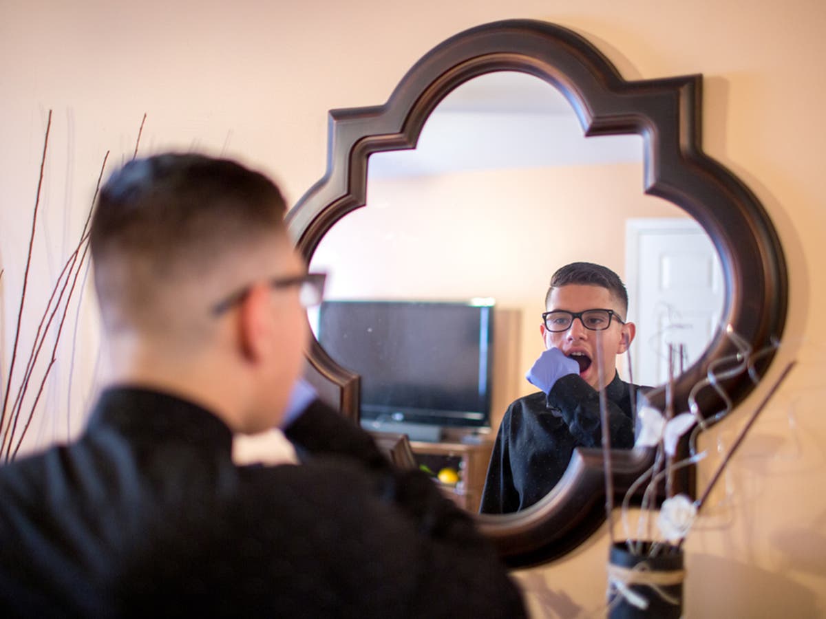 This is what it's like when your face is incapable of smiling | The ...