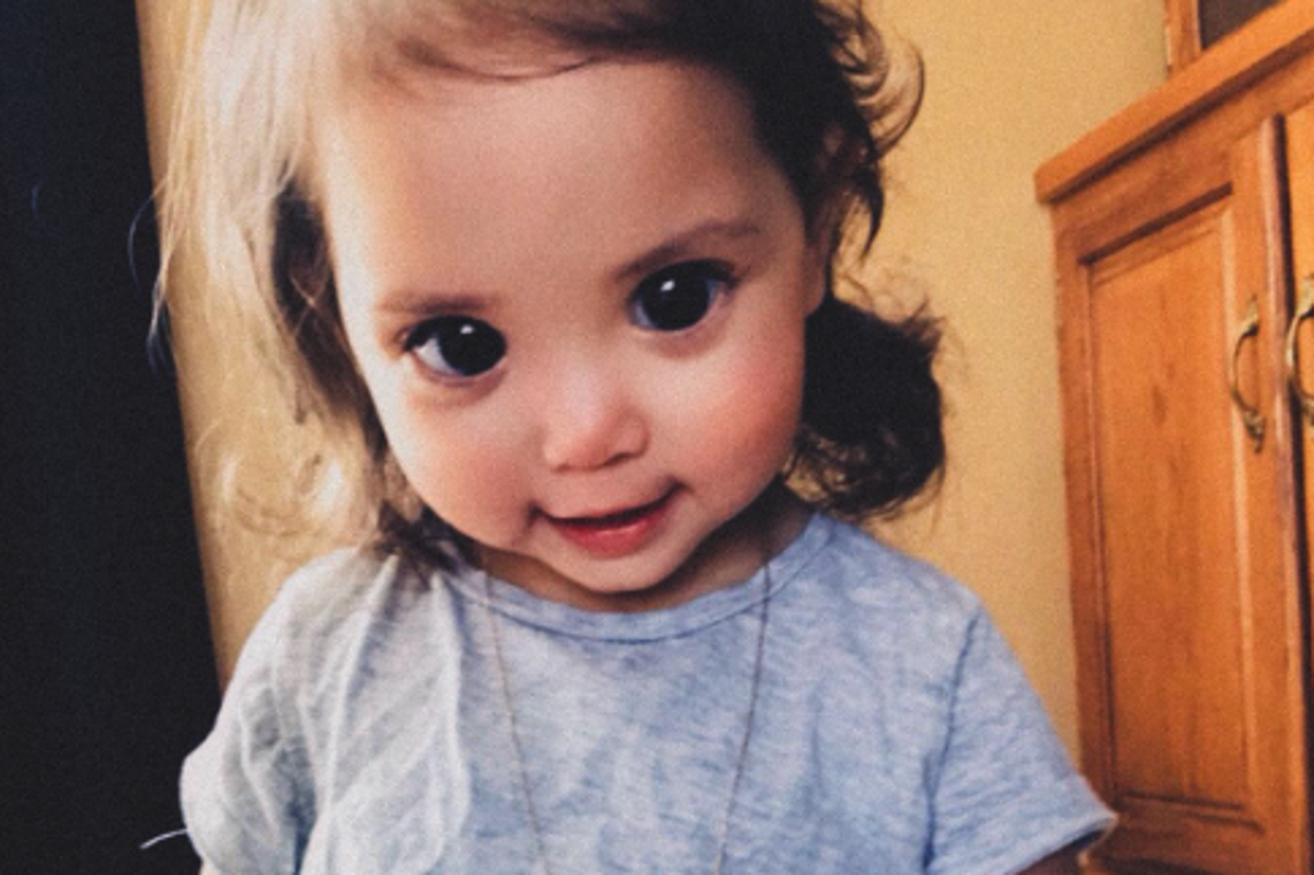 Two-year-old's 'beautiful' huge eyes are result of rare genetic ...