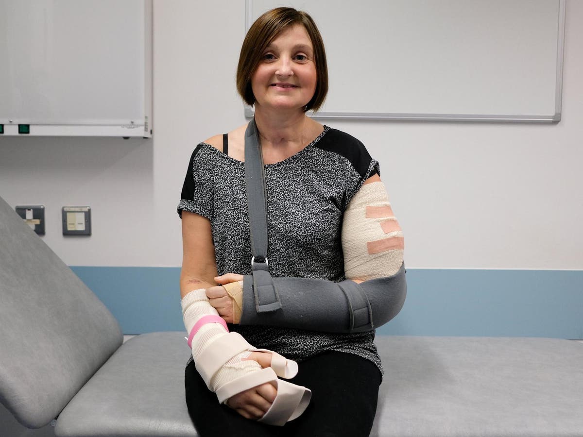 Mother Of Three Becomes First Woman In Uk To Have Double Hand
