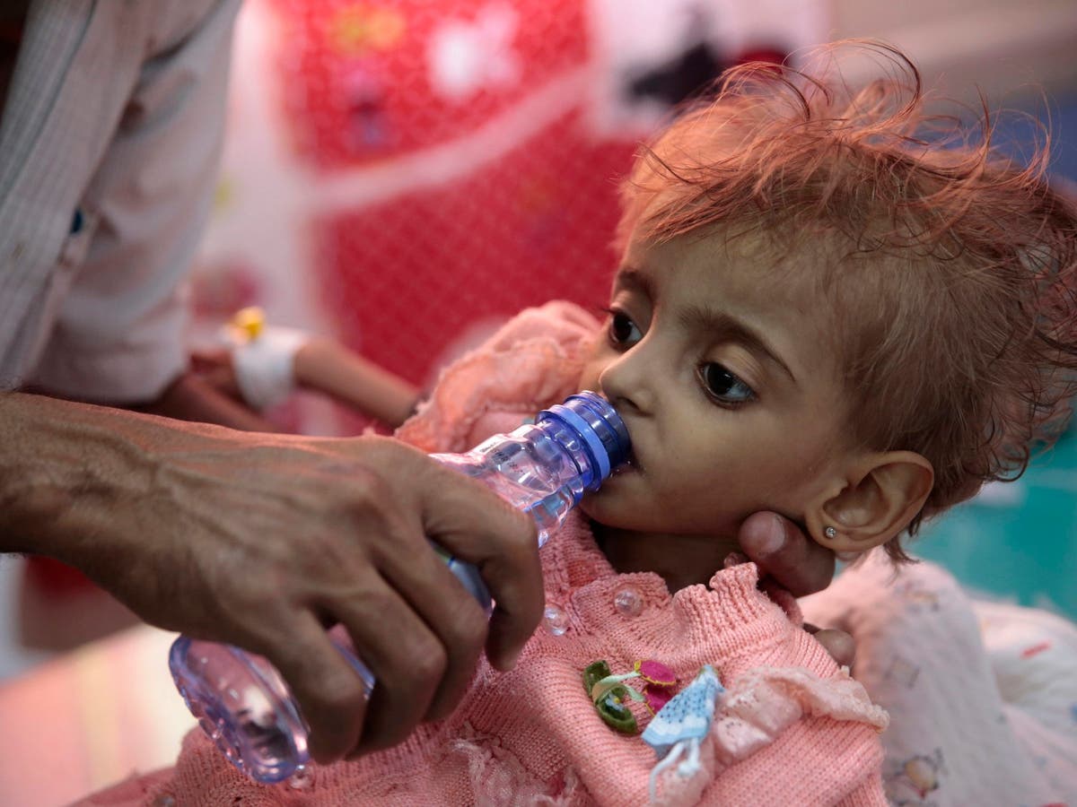 Facebook temporarily bans posts of article with image of starving girl ...