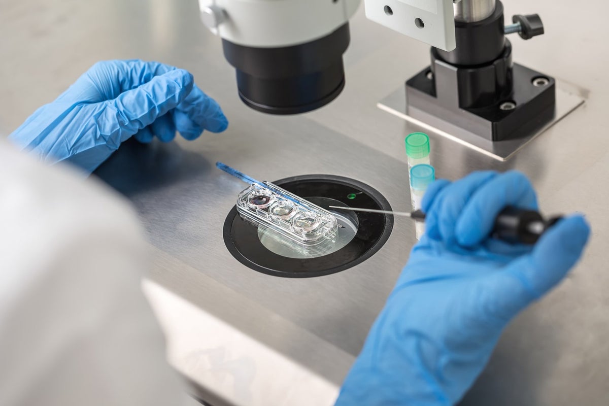 Skin cell breakthrough offers new hope for infertility patients | The ...