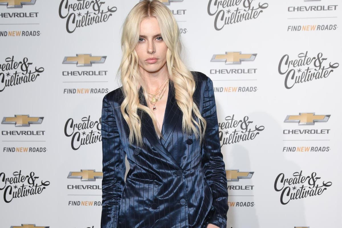 Model who lost both legs to toxic shock syndrome reveals she is ...