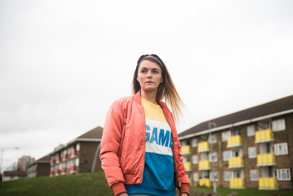 Dirty God review: An extraordinarily intimate study of an acid attack ...