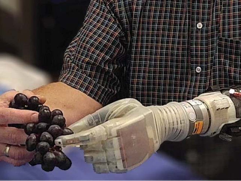 Robotic arm named after Luke Skywalker enables amputee to touch and ...