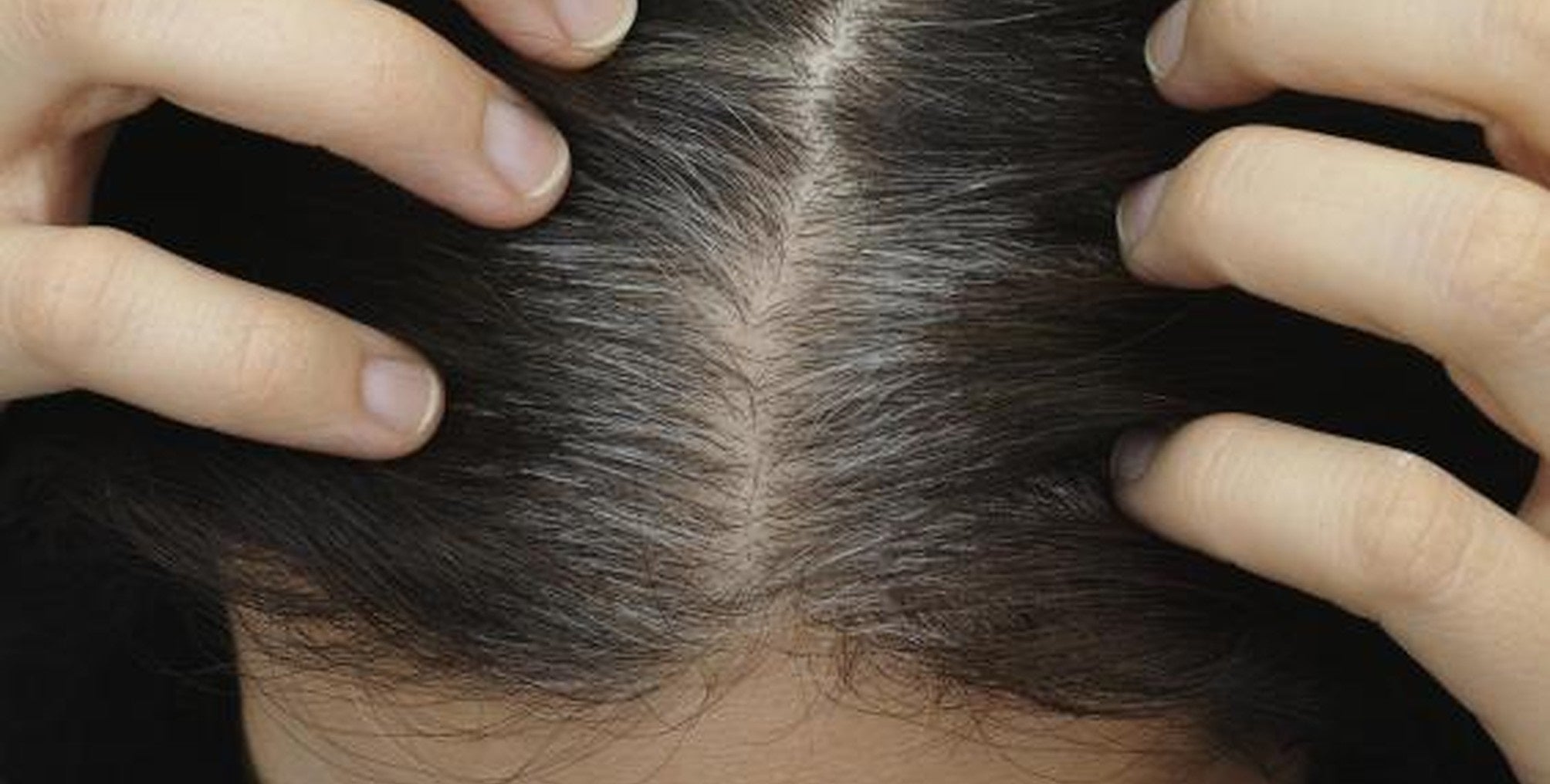 Why hair turns grey from stress and how to prevent it | indy100 | indy100