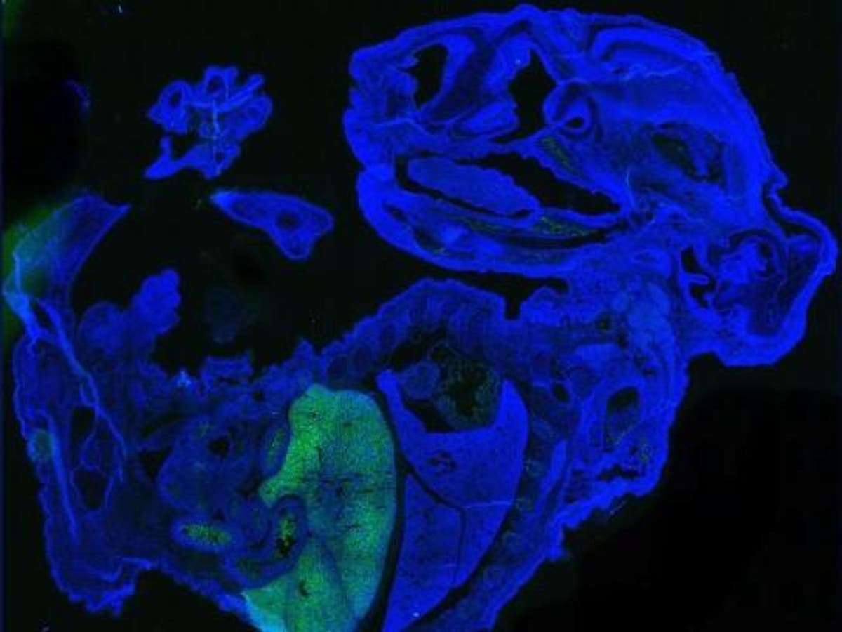 Scientists make 'human-mouse chimera' that's 4% human | The Independent ...