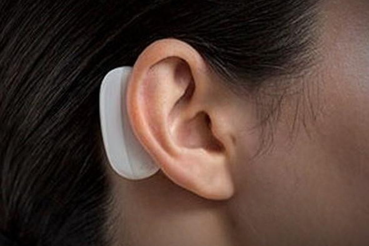 Elon Musk claims his mysterious brain chip will allow people to hear ...